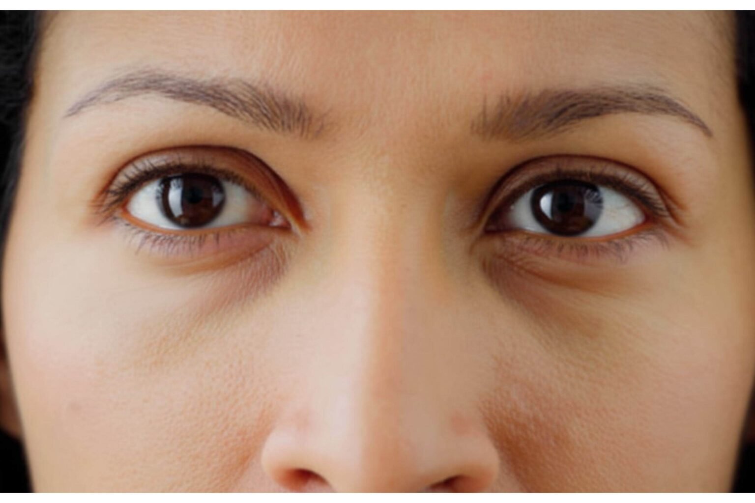 How Nutrition Deficiencies Show Up In Your Eyes And Solutions